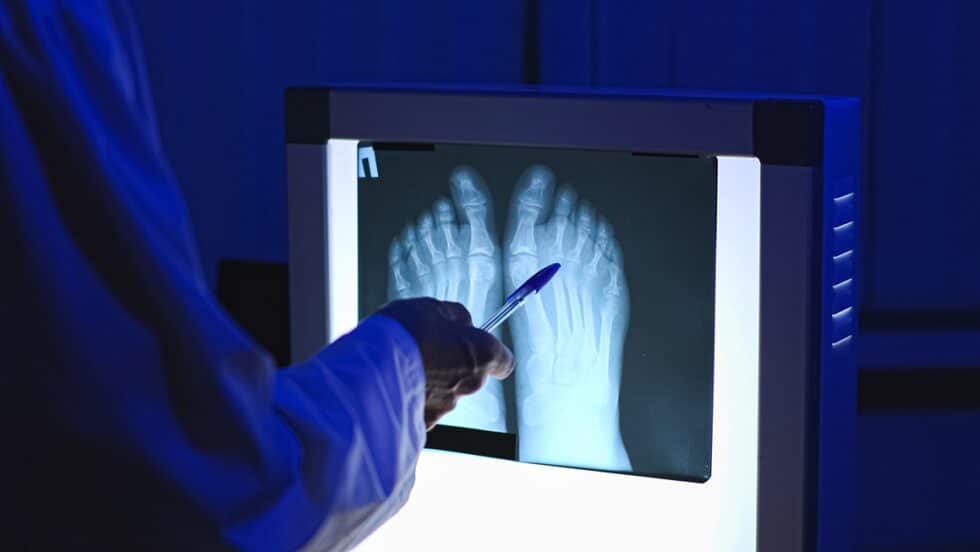 Choosing Podiatry Diagnostic Imaging: A Buyer's Guide